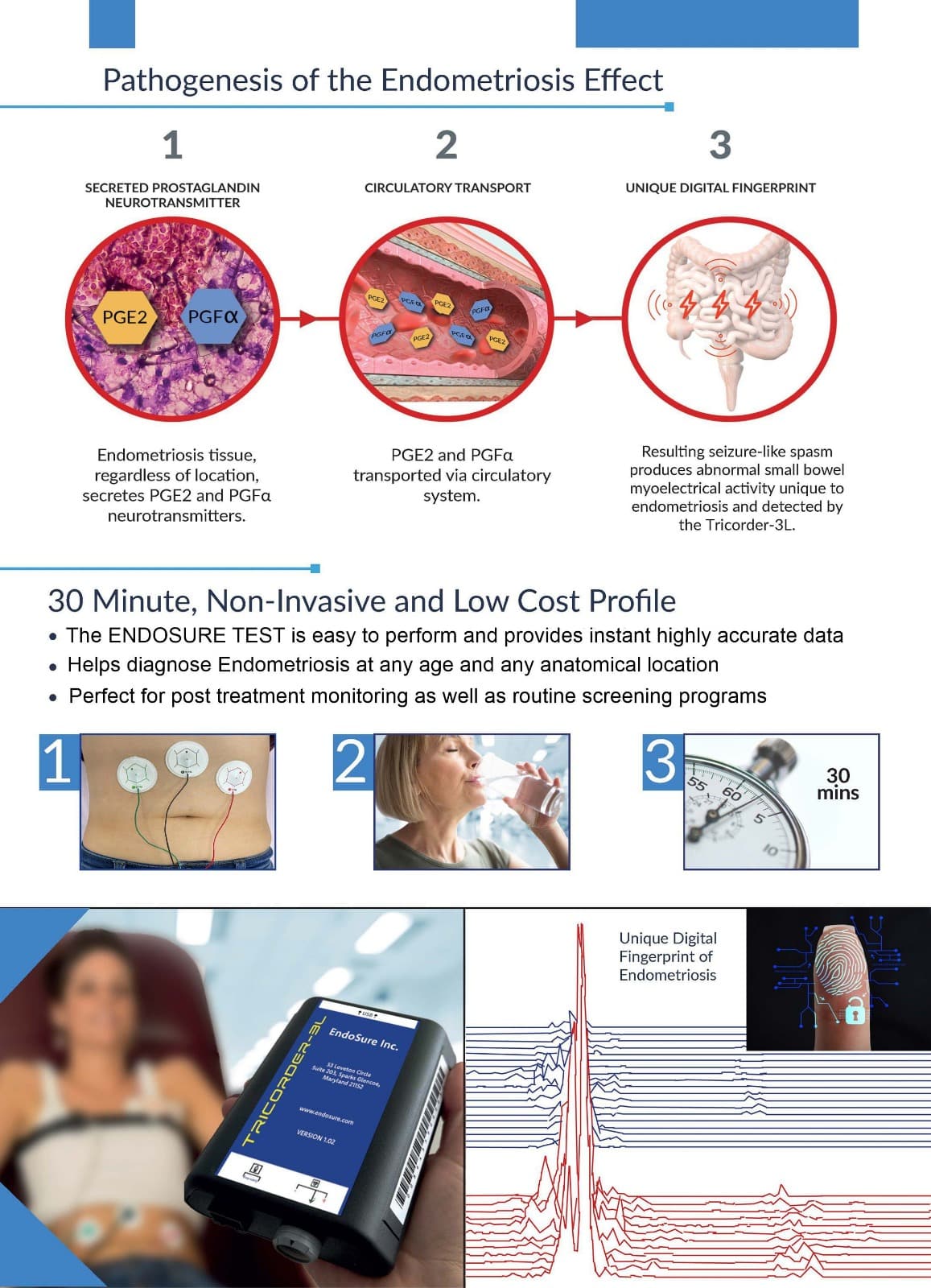 EndoDiagnosis, Inc Exhibits TIER-1 ENDOSURE Diagnostic Test for ...